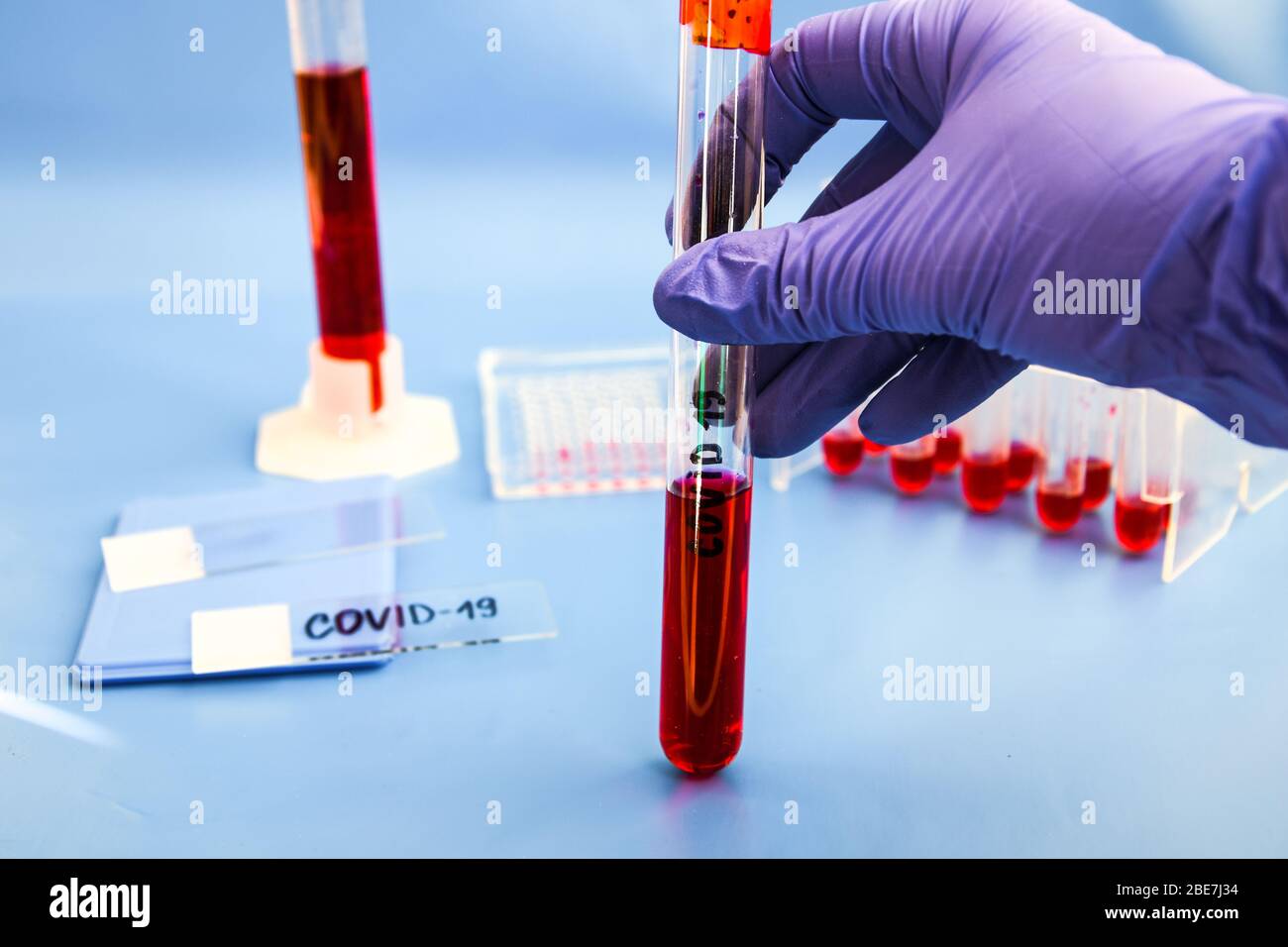 Coronavirus Blood Sample, DNA testing of the blood in the laboratory ...