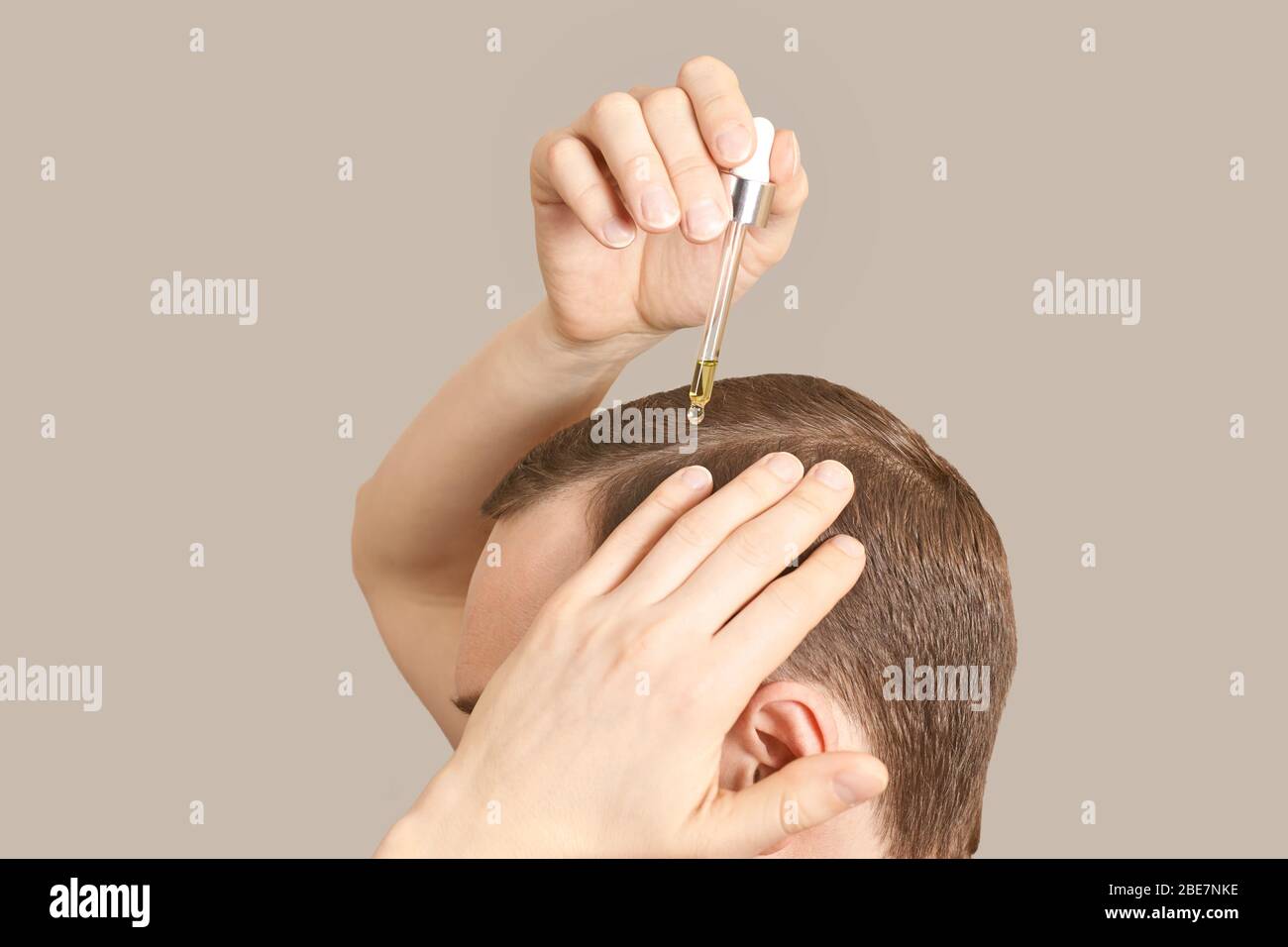 Man baldness treatment. Nature hair care Stock Photo - Alamy