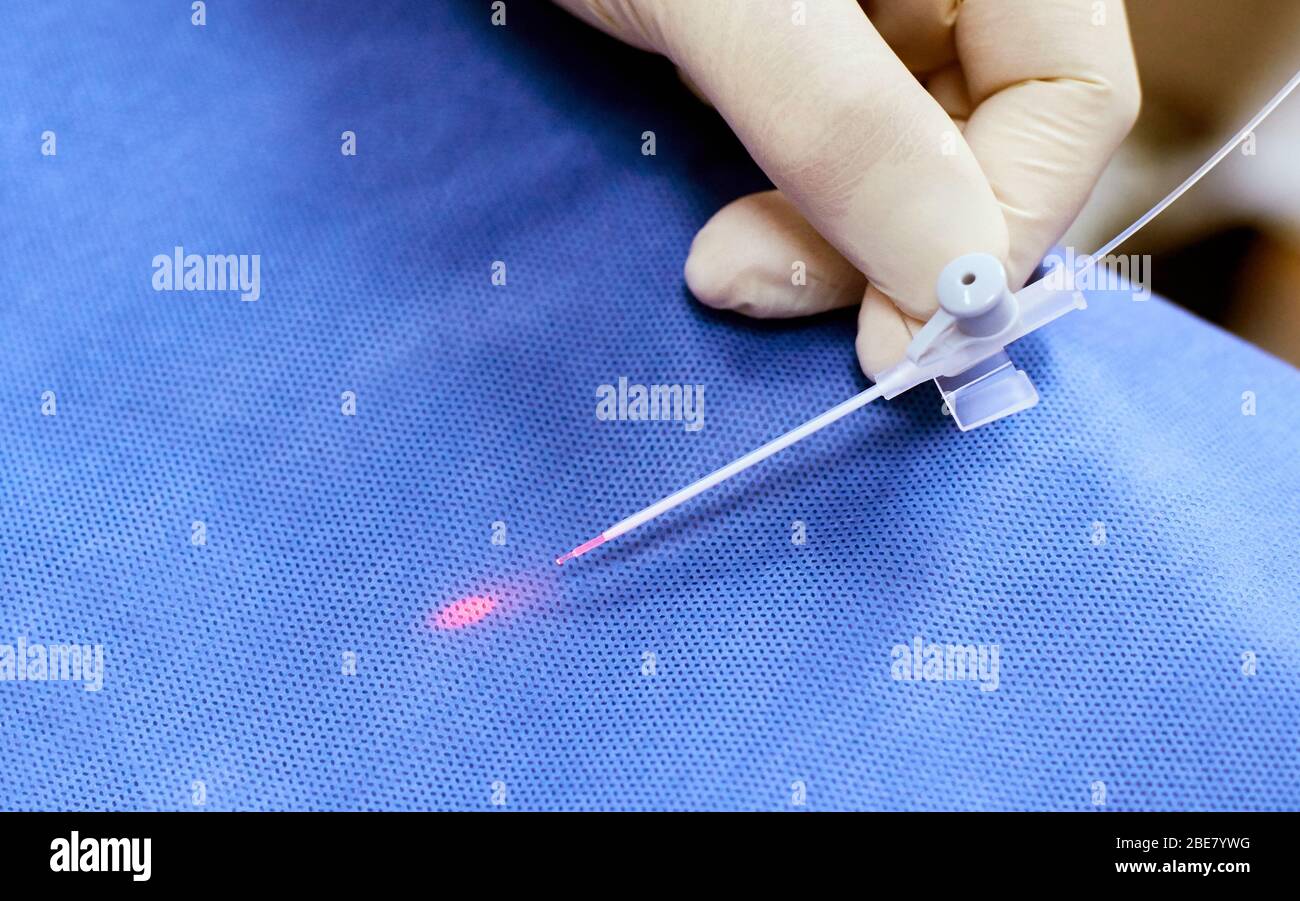 Laser removal veins. Treatment couperose device. Varicose asteriks ...