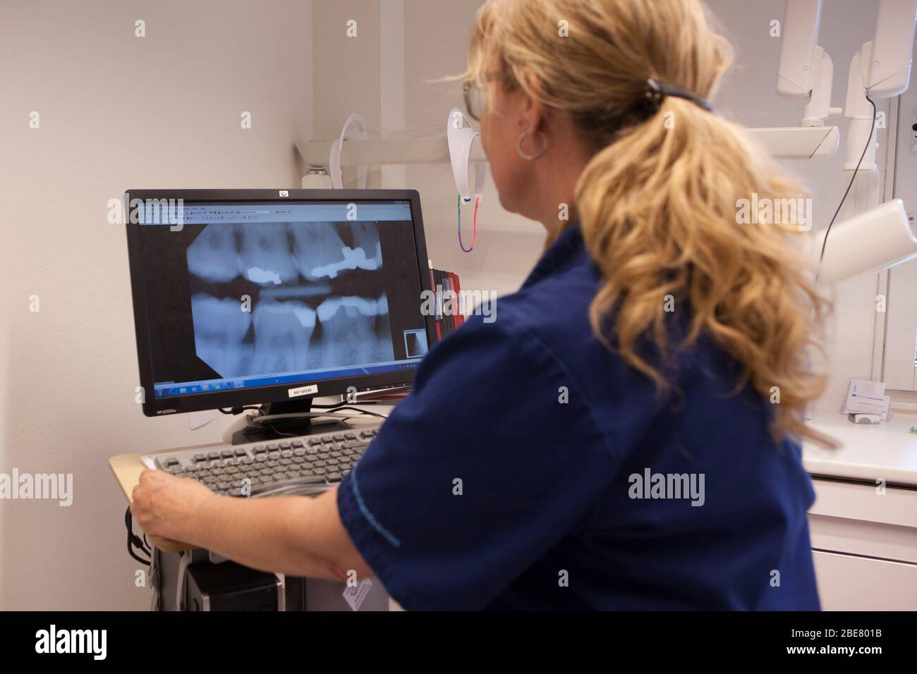 X ray of teeth hi-res stock photography and images - Alamy