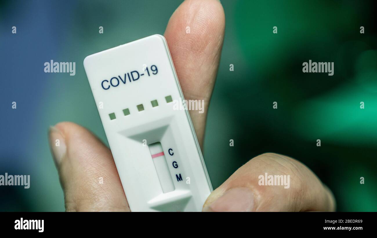 Covid-19 rapid antibodies test kit IgM IgG Stock Photo - Alamy