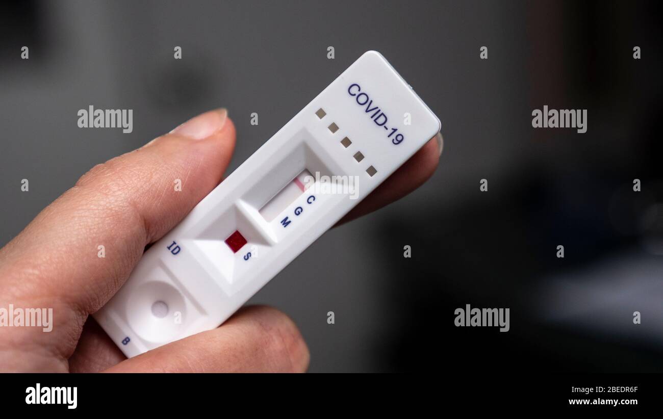 Covid-19 rapid antibodies test kit IgM IgG Stock Photo - Alamy
