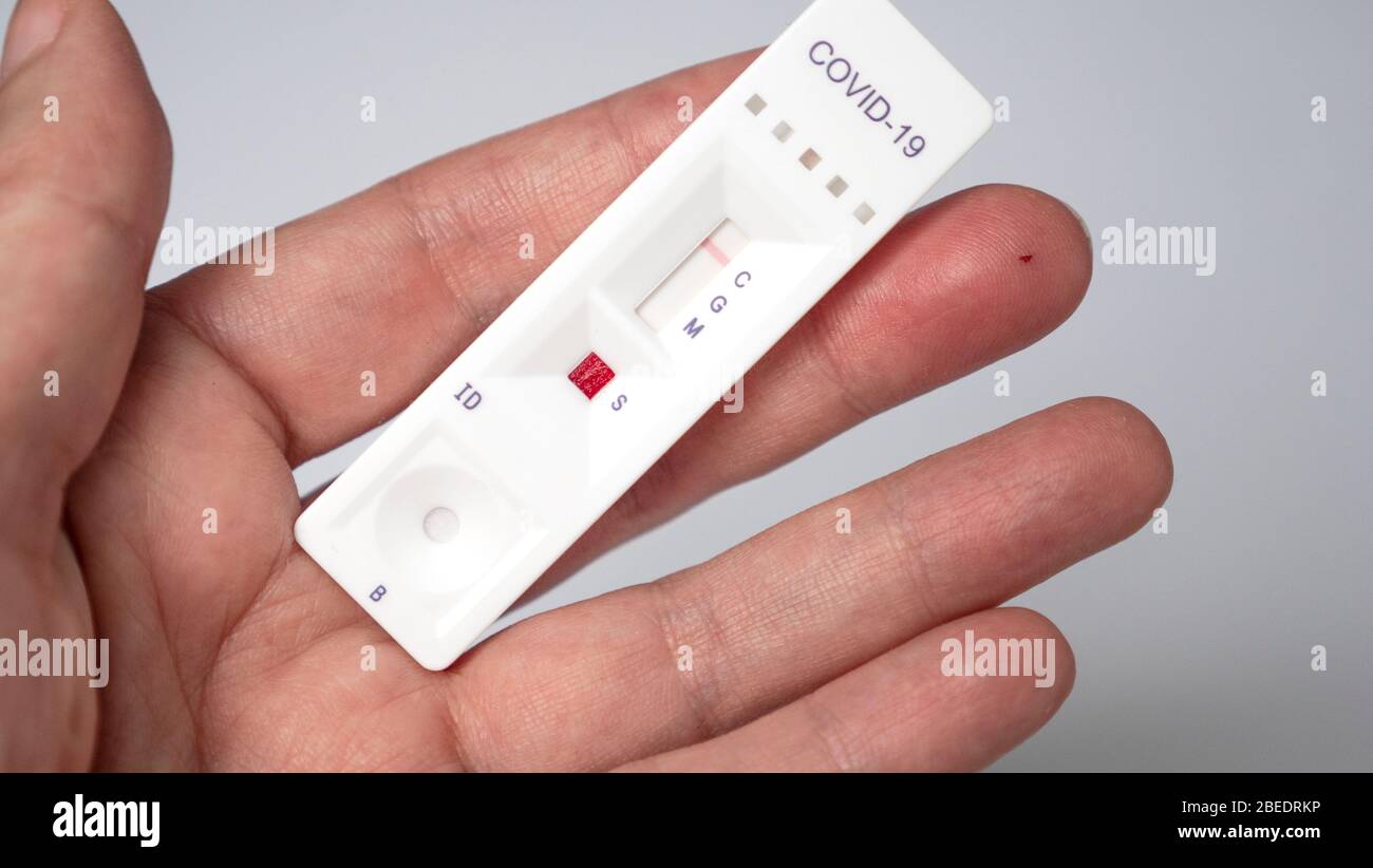 Covid-19 rapid antibodies test kit IgM IgG Stock Photo - Alamy
