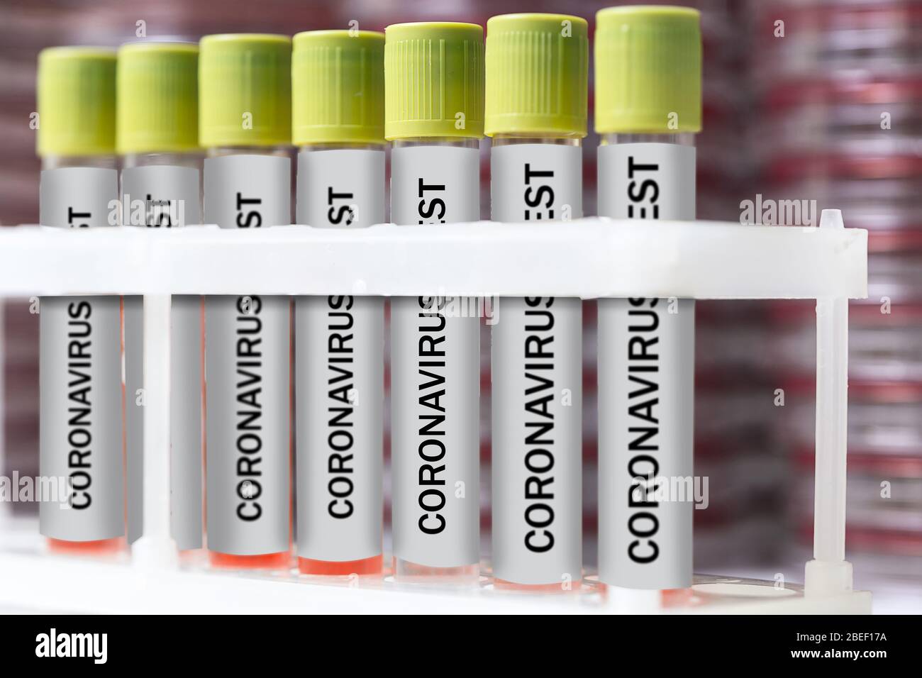Laboratory research of Coronavirus. Containers or tubes with green lids ...