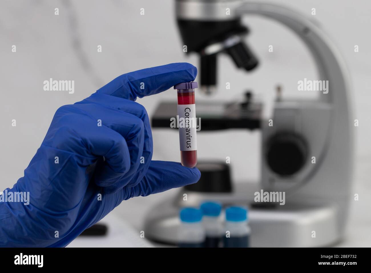 Nurse holding test tube with blood, close-up. Blood test concept Stock ...