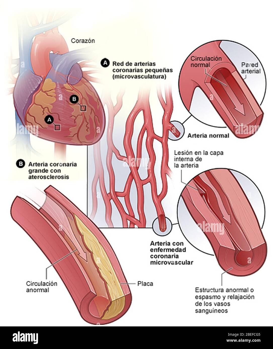 Microvascular disease hi-res stock photography and images - Alamy