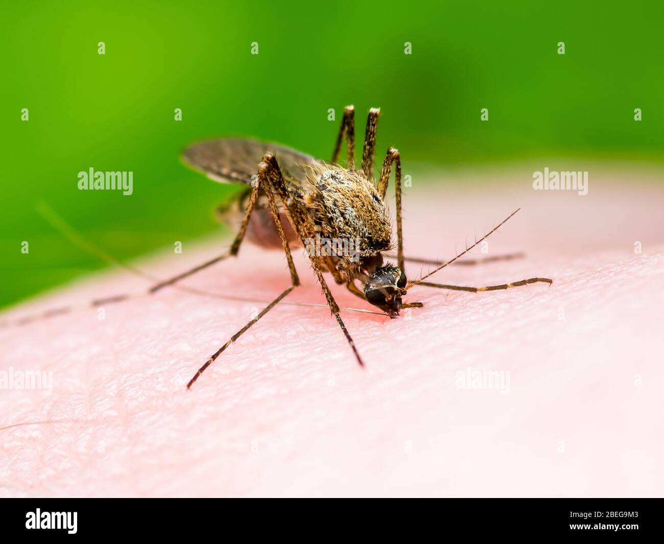 Dangerous Malaria Infected Mosquito Bite, Leishmaniasis, Encephalitis ...