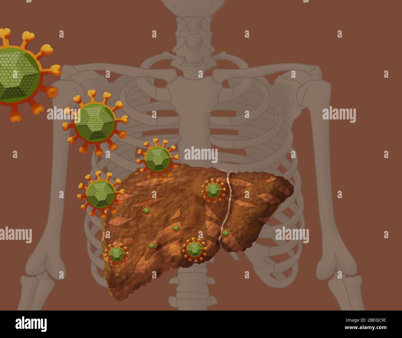 Chronic liver disease and cirrhosis hi-res stock photography and images ...
