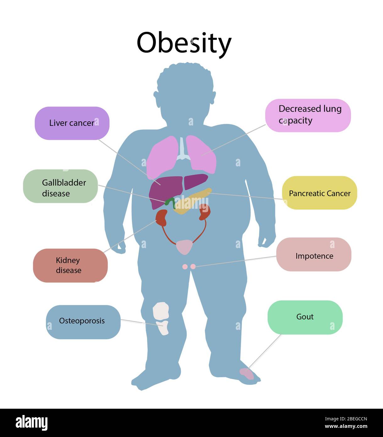 Human fat diagram hi-res stock photography and images - Alamy