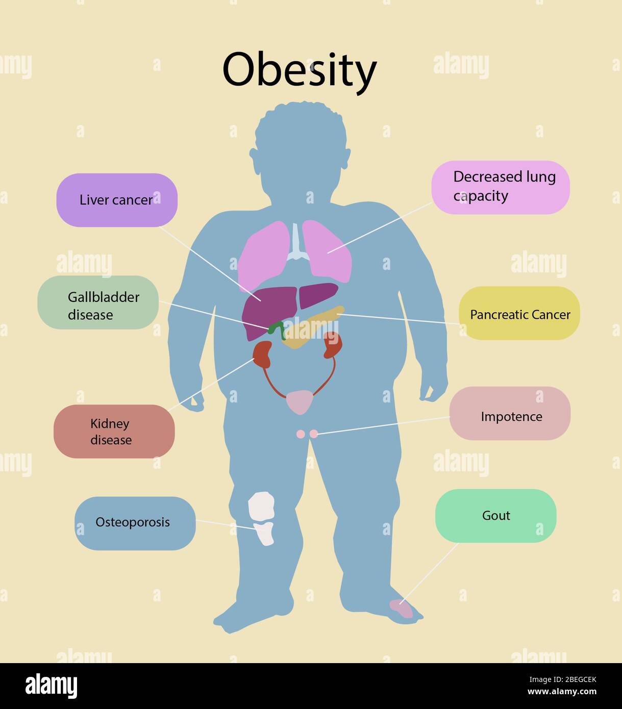 Human fat diagram hi-res stock photography and images - Alamy