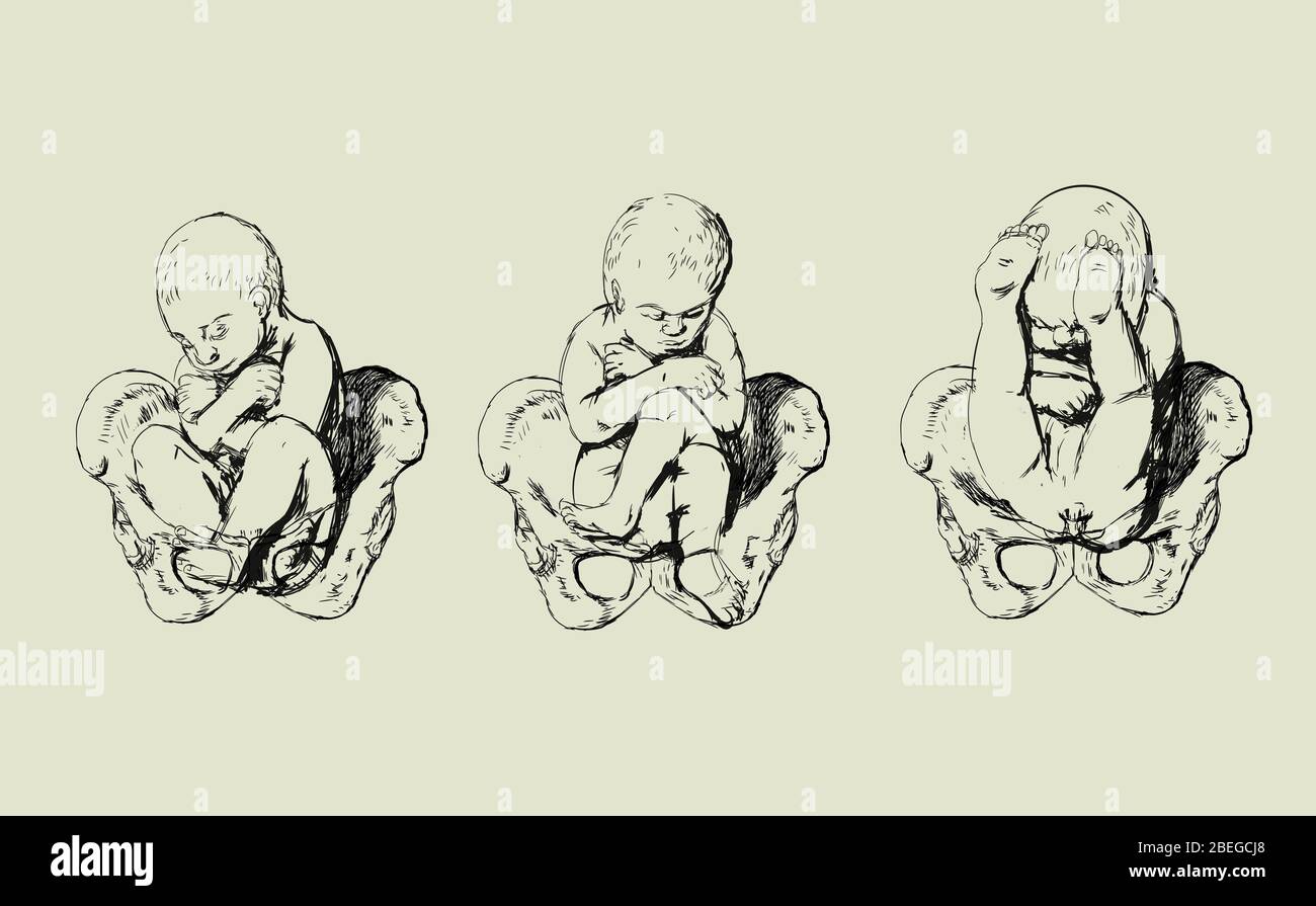 Fetal Position Baby High Resolution Stock Photography and Images - Alamy