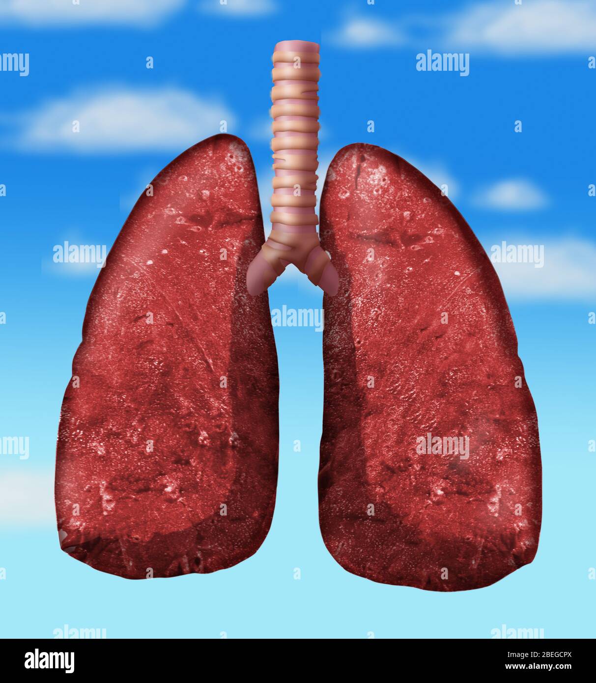 Normal Healthy Lungs High Resolution Stock Photography and Images - Alamy