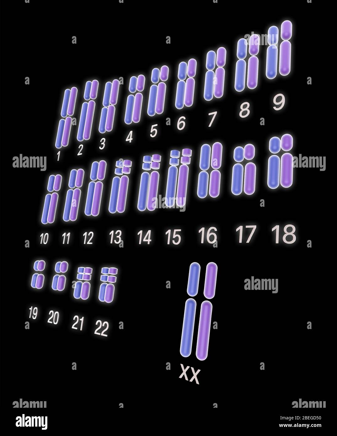 Karyotype, Female, Illustration Stock Photo - Alamy