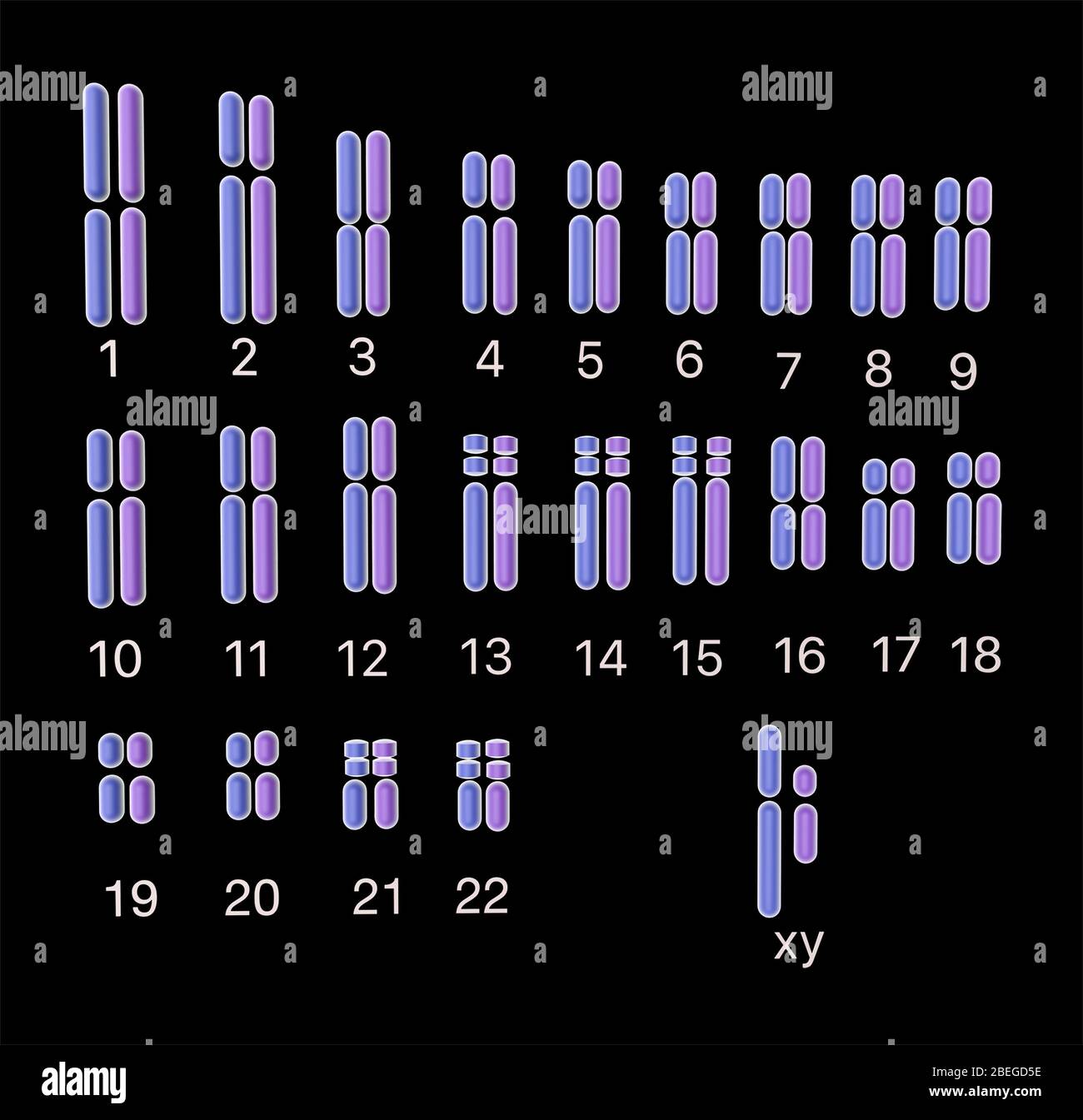 Karyotypes And Karyotyping Karyotype Wikipedia