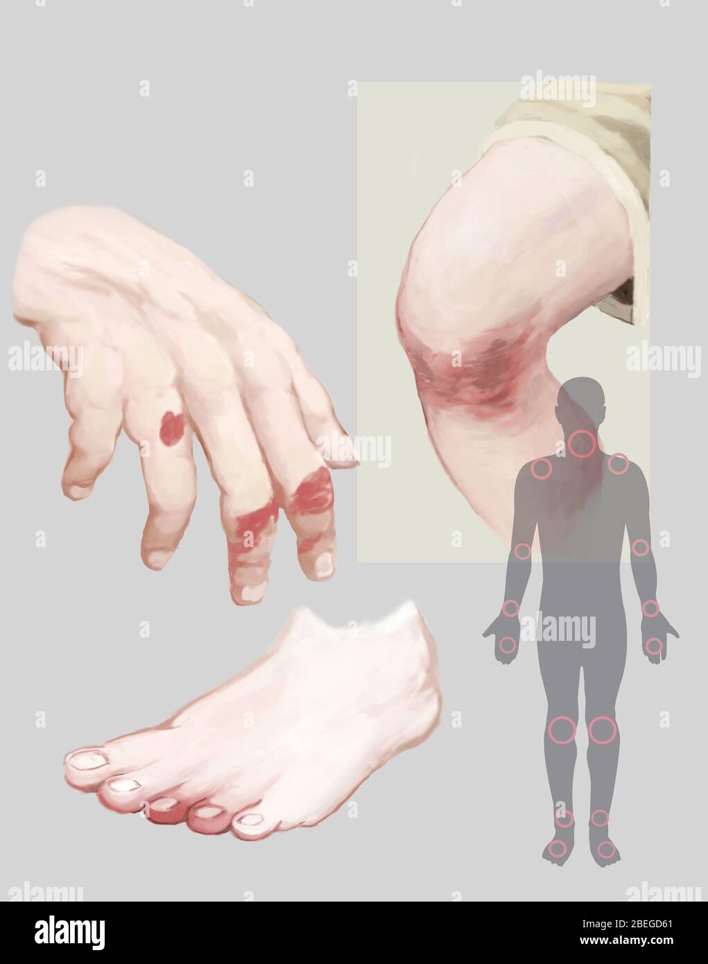 Medical foot illustration hi-res stock photography and images - Alamy