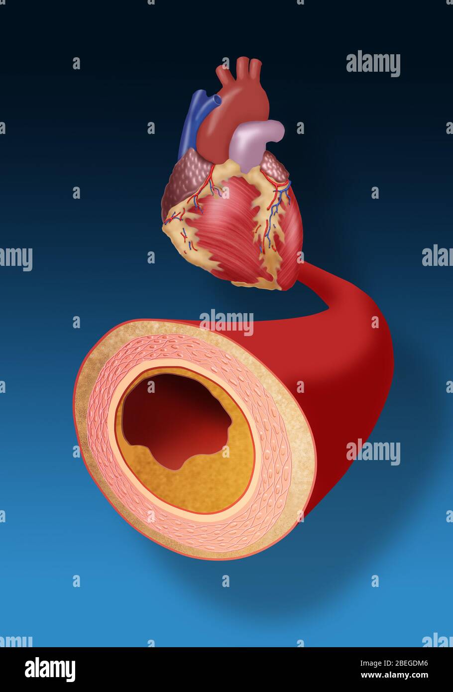 Cross section artery hi-res stock photography and images - Alamy