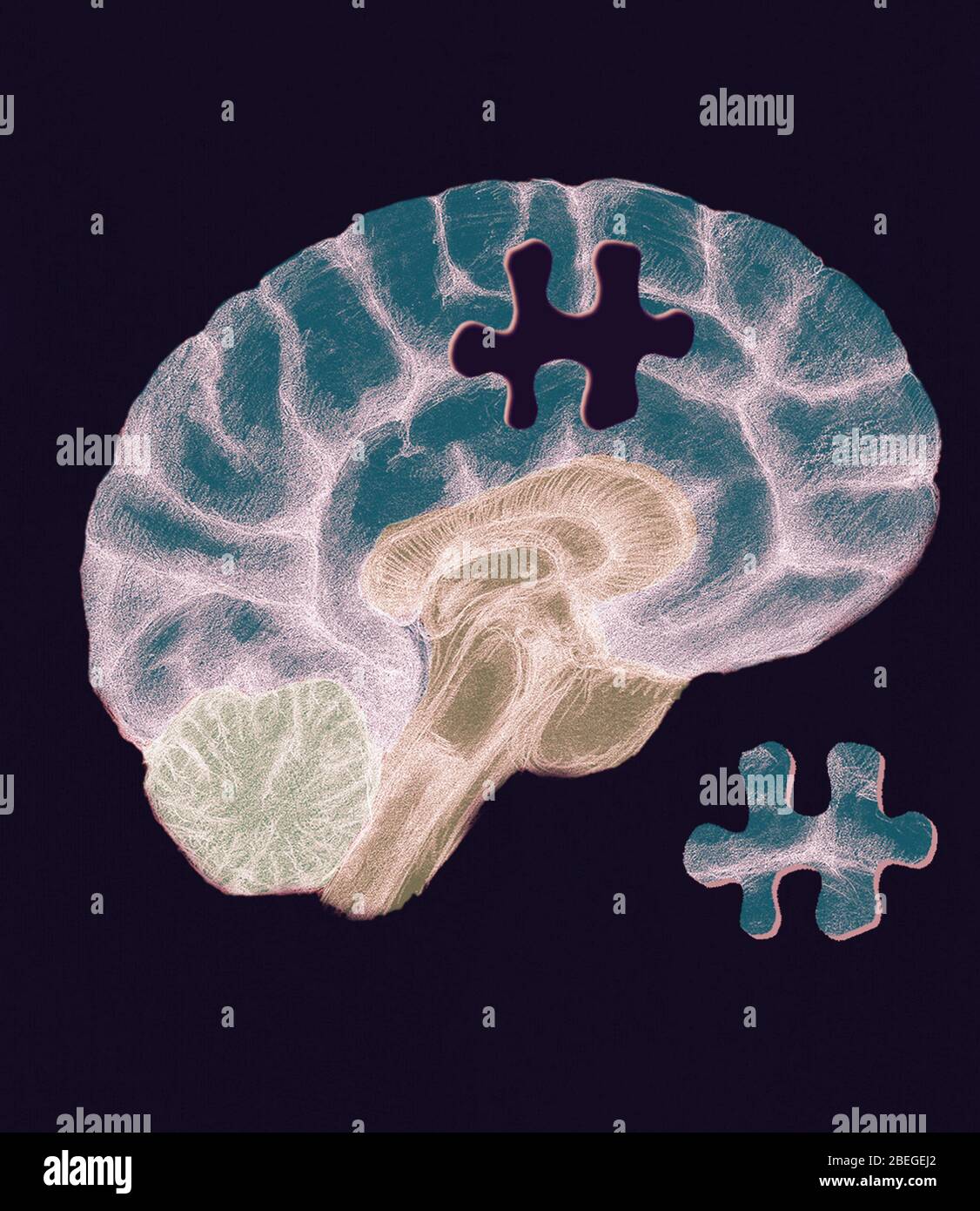 Missing Brain Piece Stock Photo - Alamy