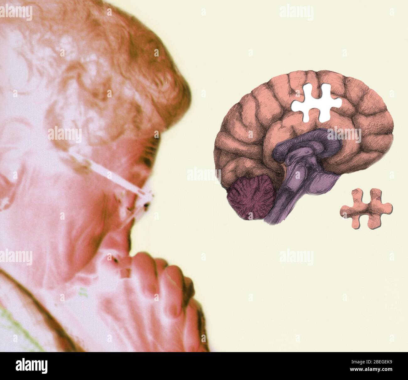 Alzheimer's Disease or Memory Loss Stock Photo - Alamy