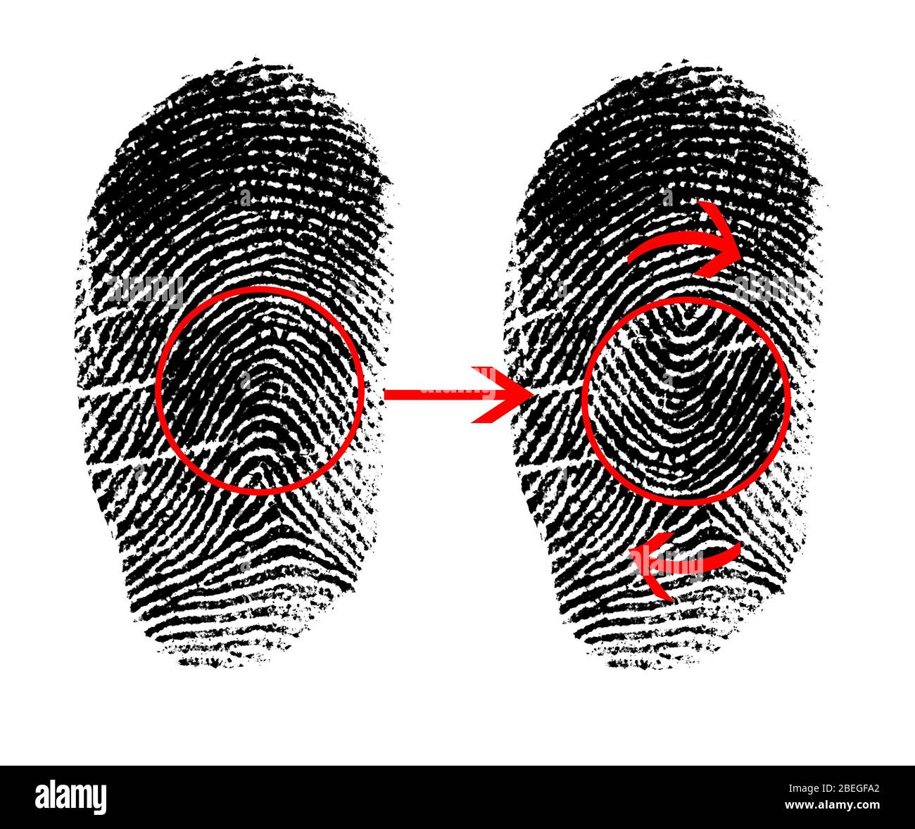 Mutilated finger hi-res stock photography and images - Alamy