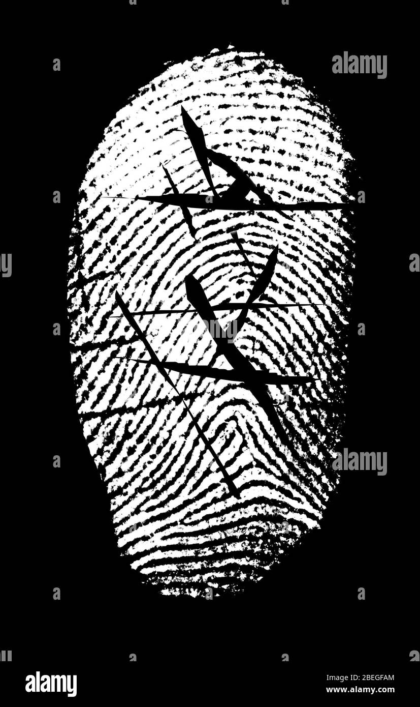 Mutilated finger Black and White Stock Photos & Images - Alamy