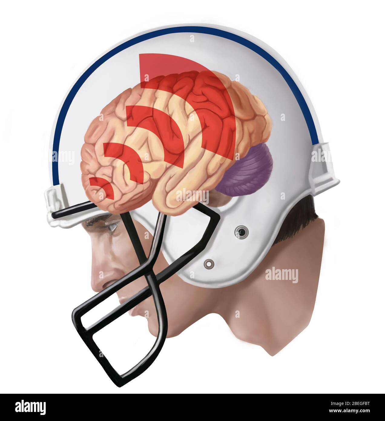Cte brain hi-res stock photography and images - Alamy