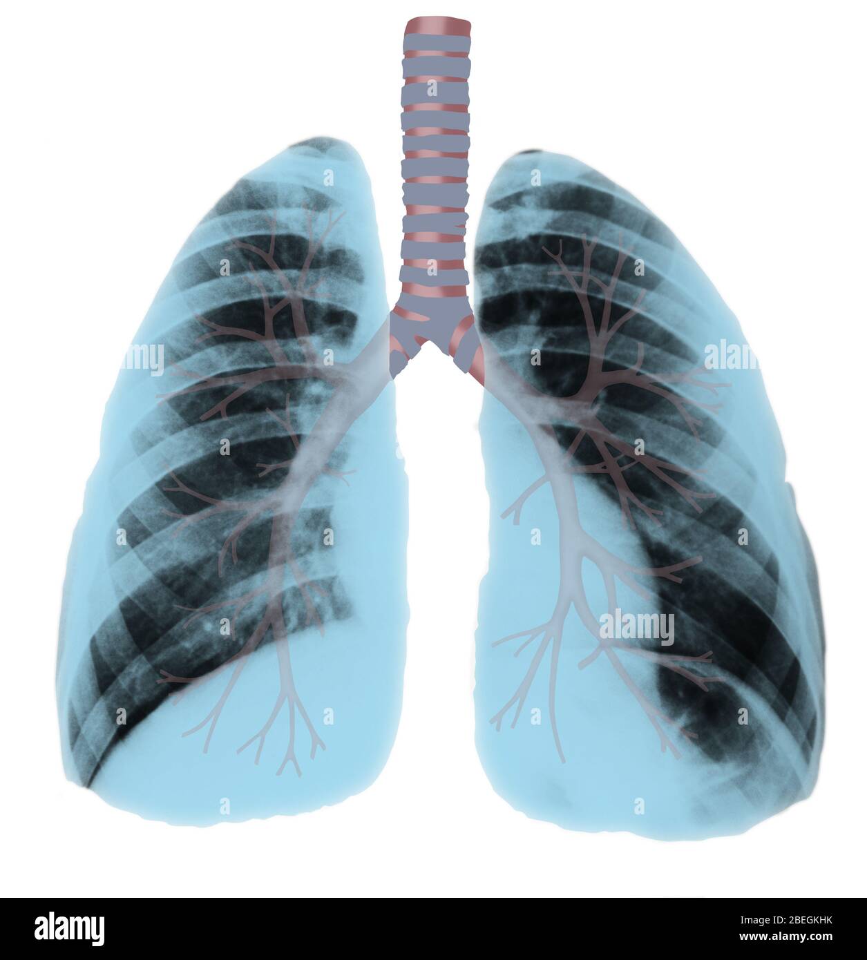 Bronchial Tubes High Resolution Stock Photography and Images - Alamy