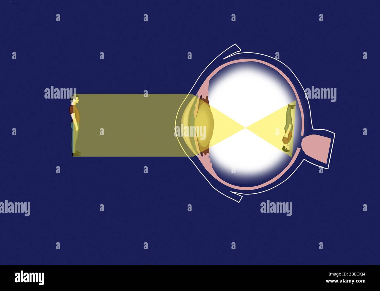 Medical diagram of eye hi-res stock photography and images - Alamy
