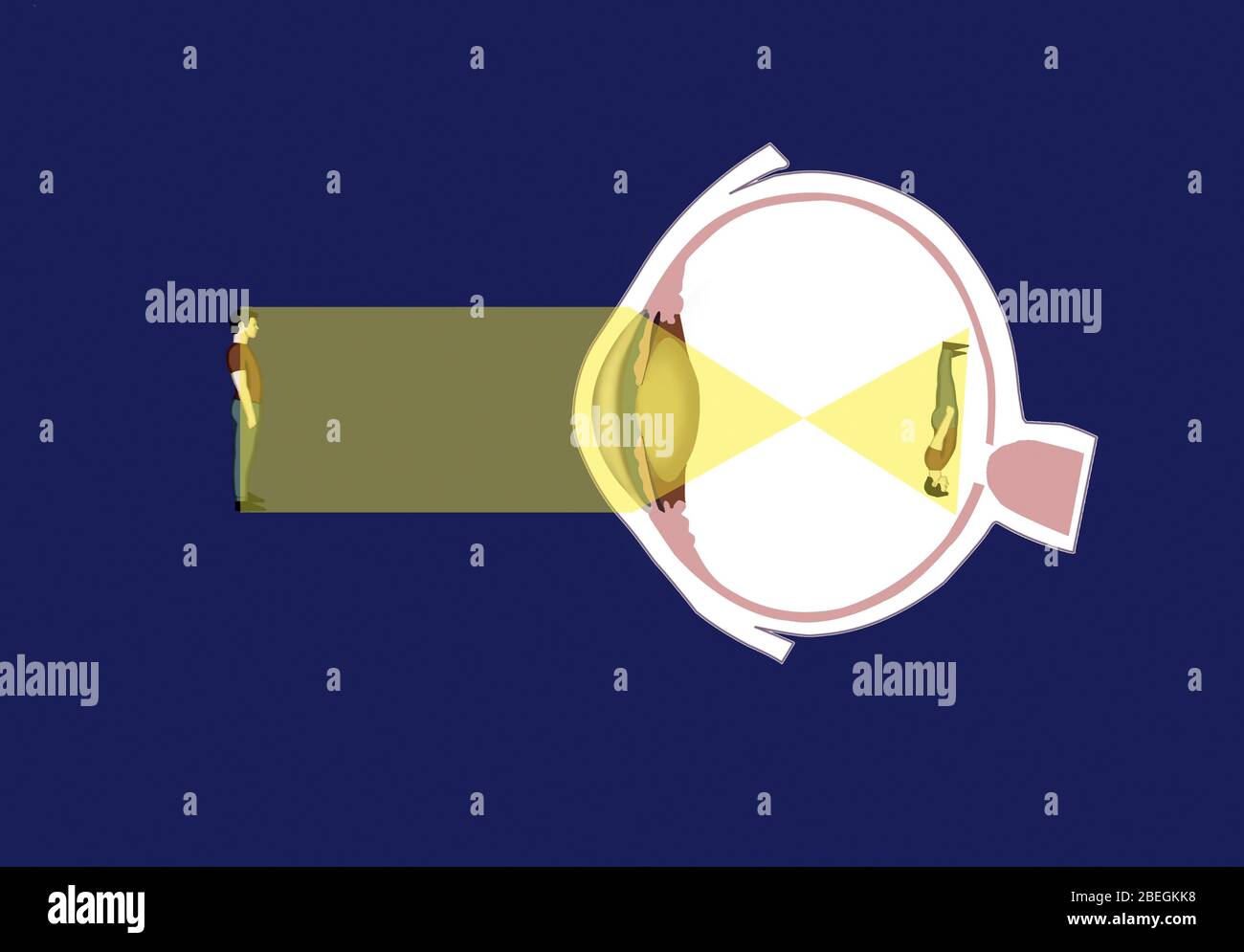 Eye diagram hi-res stock photography and images - Alamy
