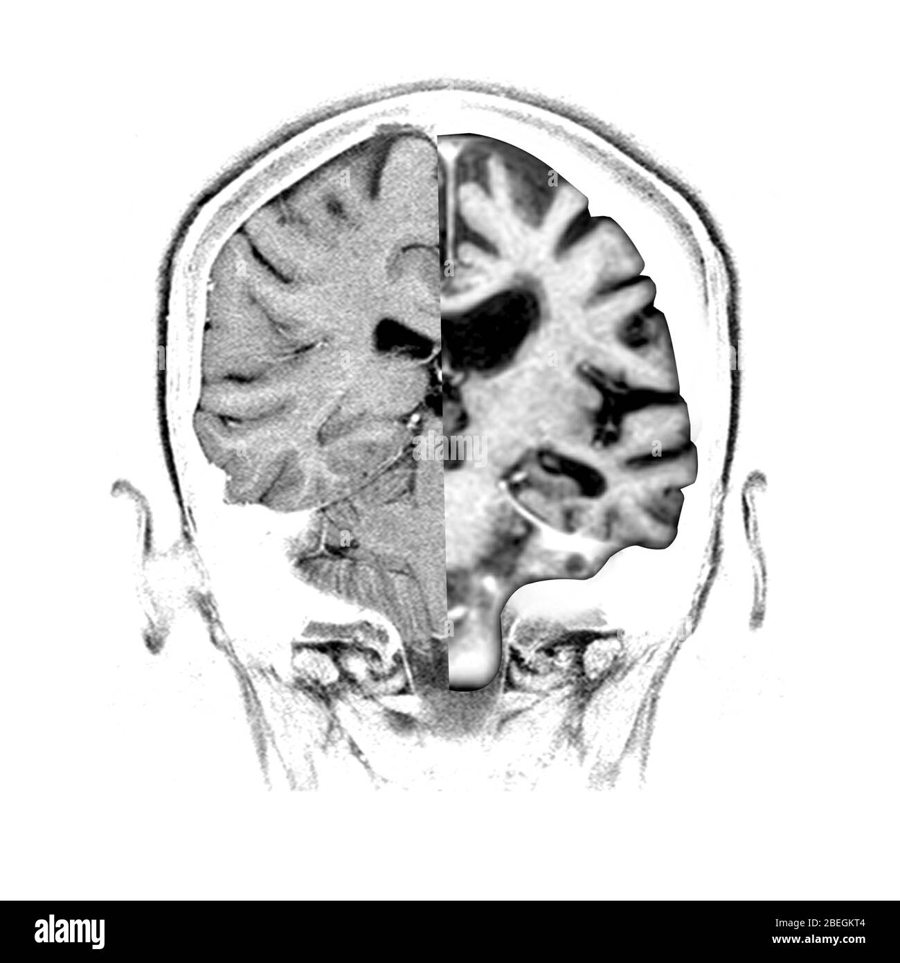 Image comparison Black and White Stock Photos & Images - Alamy