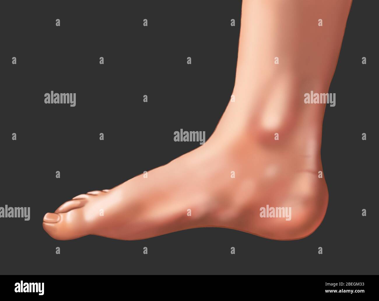Human heel anatomy hi-res stock photography and images - Alamy