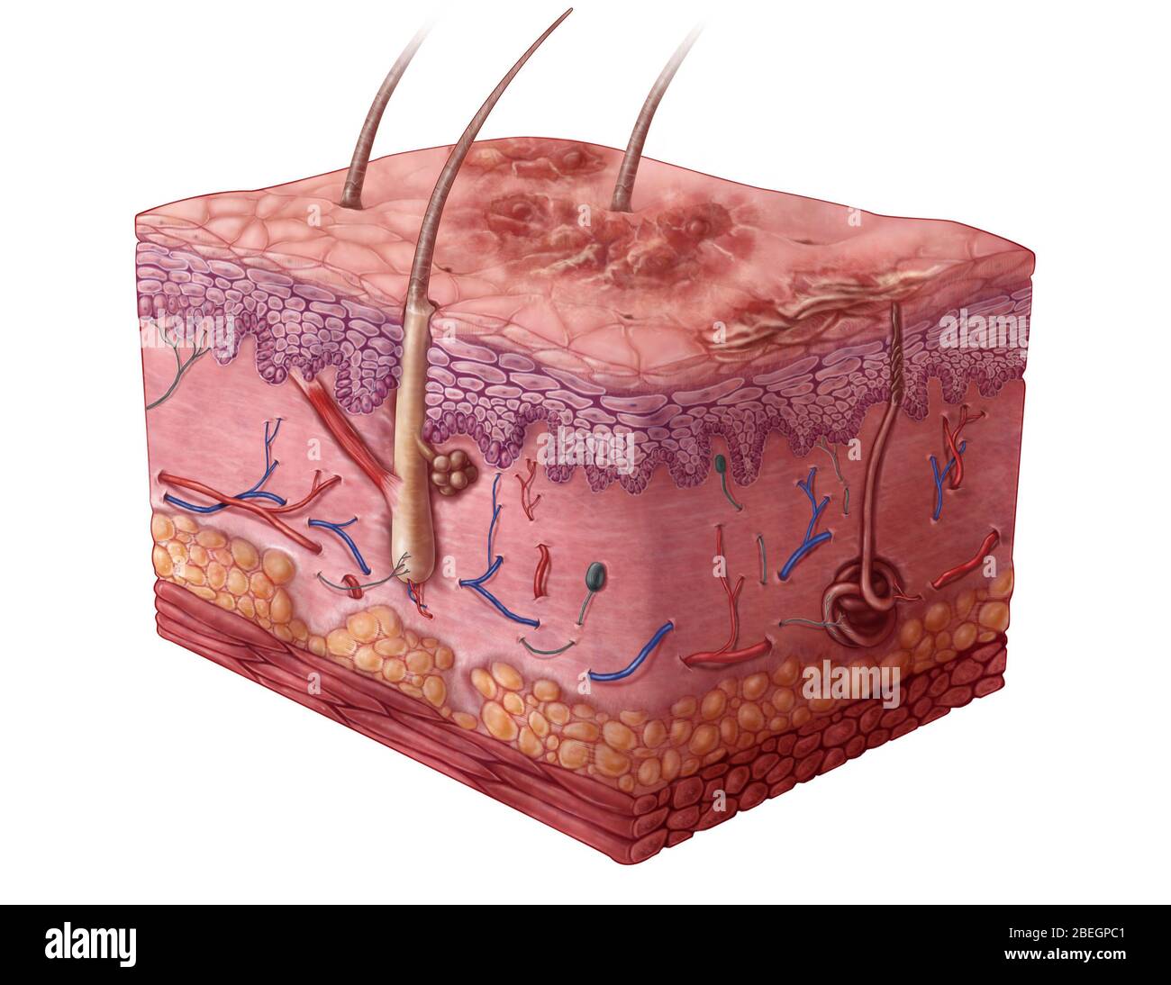 Layers of the skin hi-res stock photography and images - Alamy