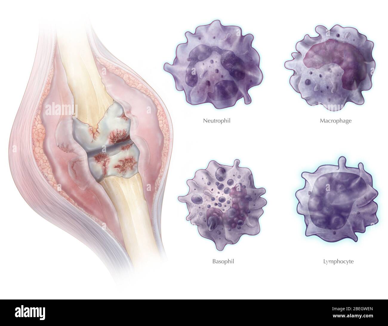 Synovial cells hi-res stock photography and images - Alamy