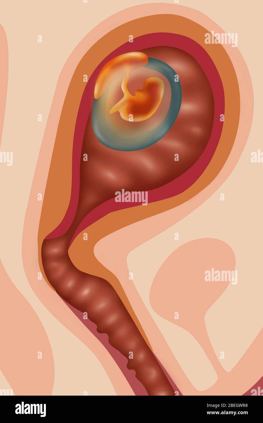 Fetal growth hi-res stock photography and images - Alamy