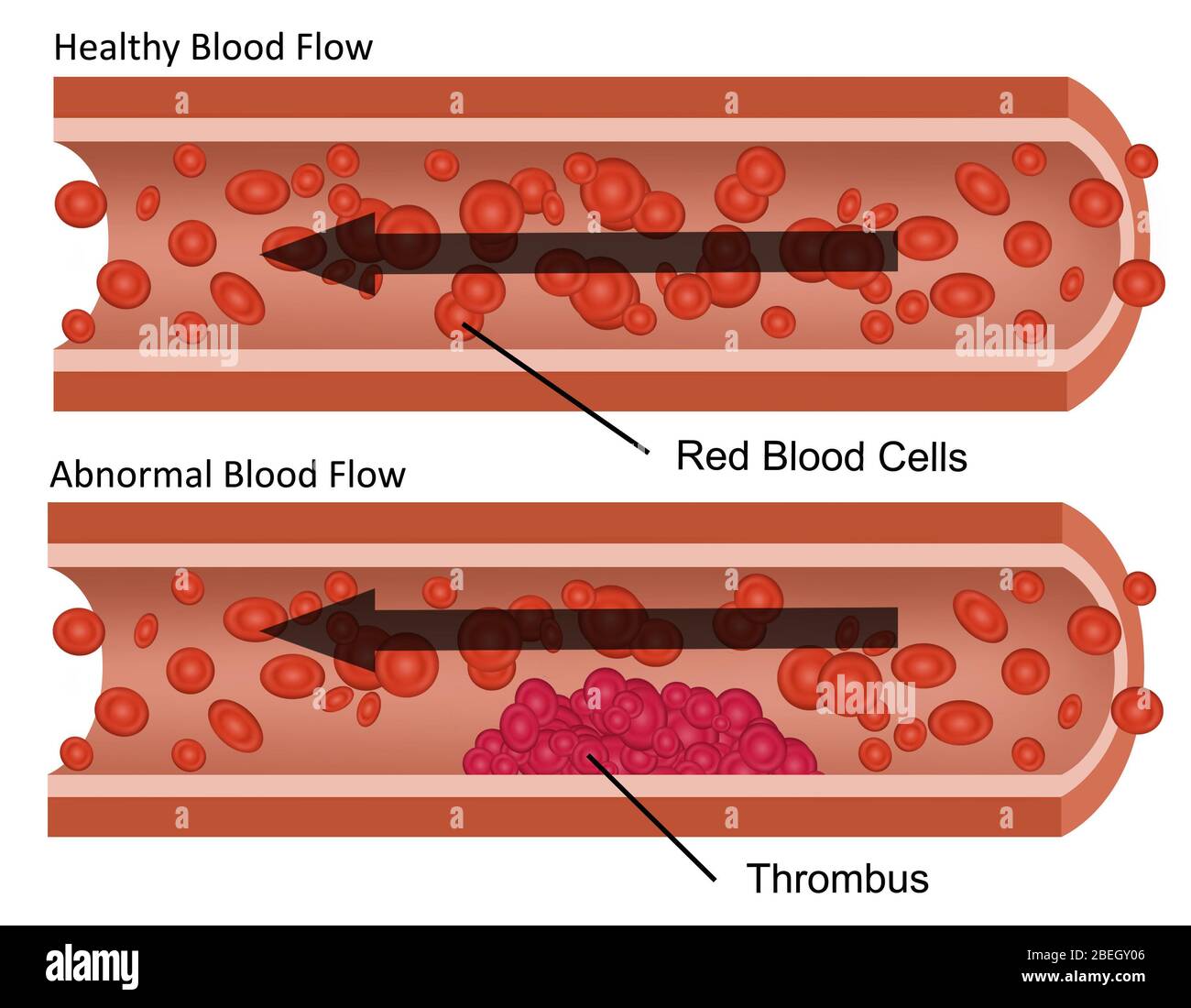 Normal blood flow Cut Out Stock Images & Pictures - Alamy