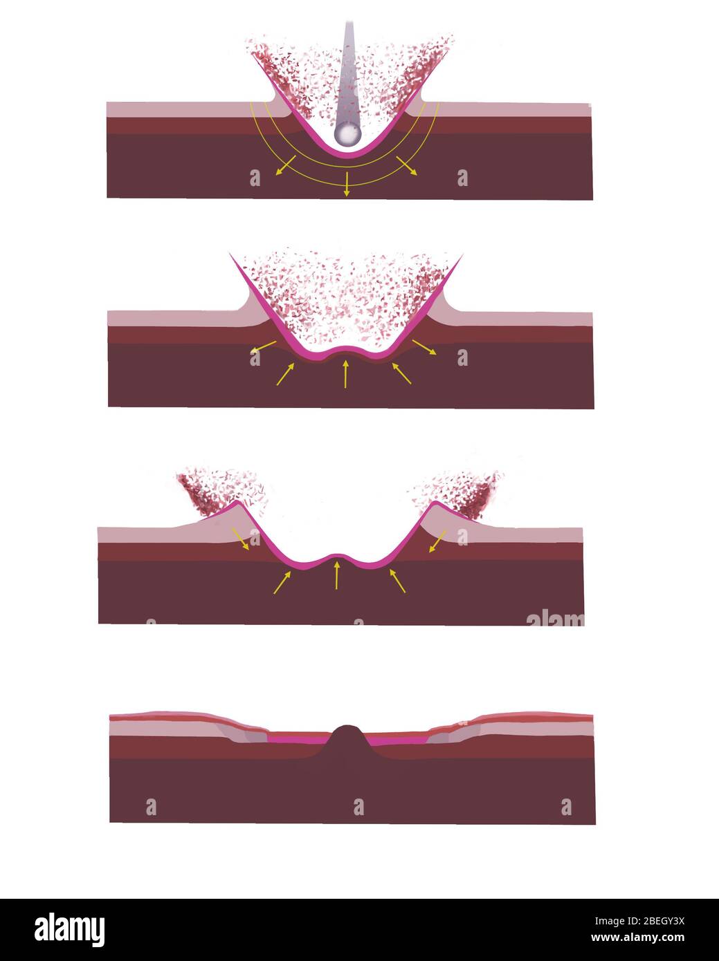 Impact Crater Formation Stock Photo - Alamy