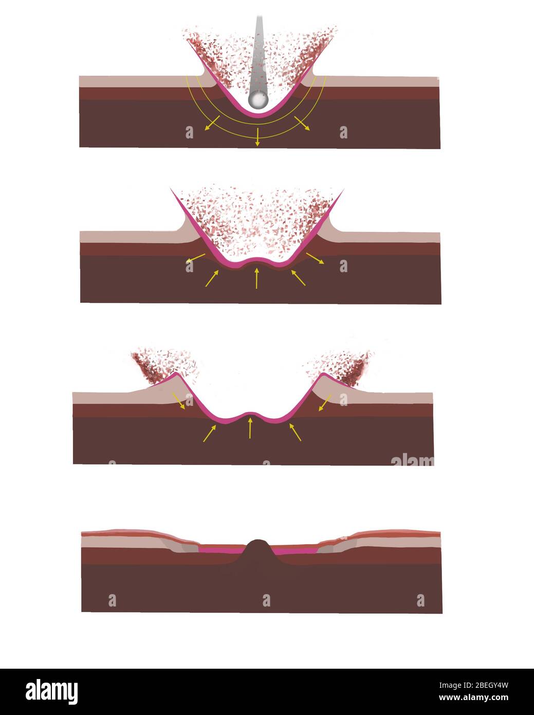 Crater formation diagram hi-res stock photography and images - Alamy