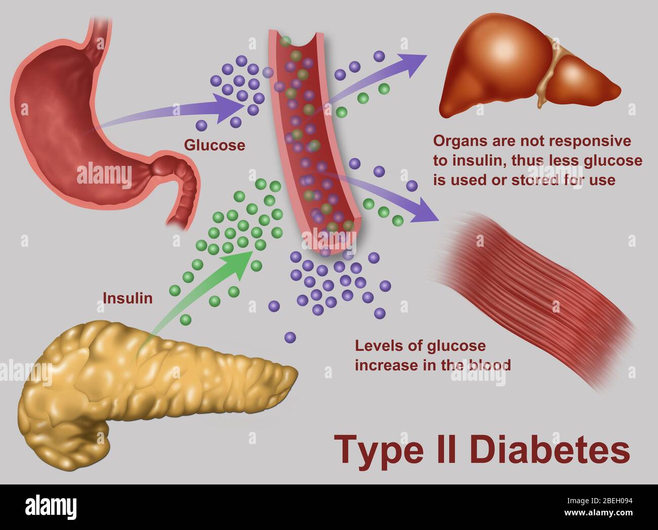 Type 2 Diabetes Stock Photo - Alamy