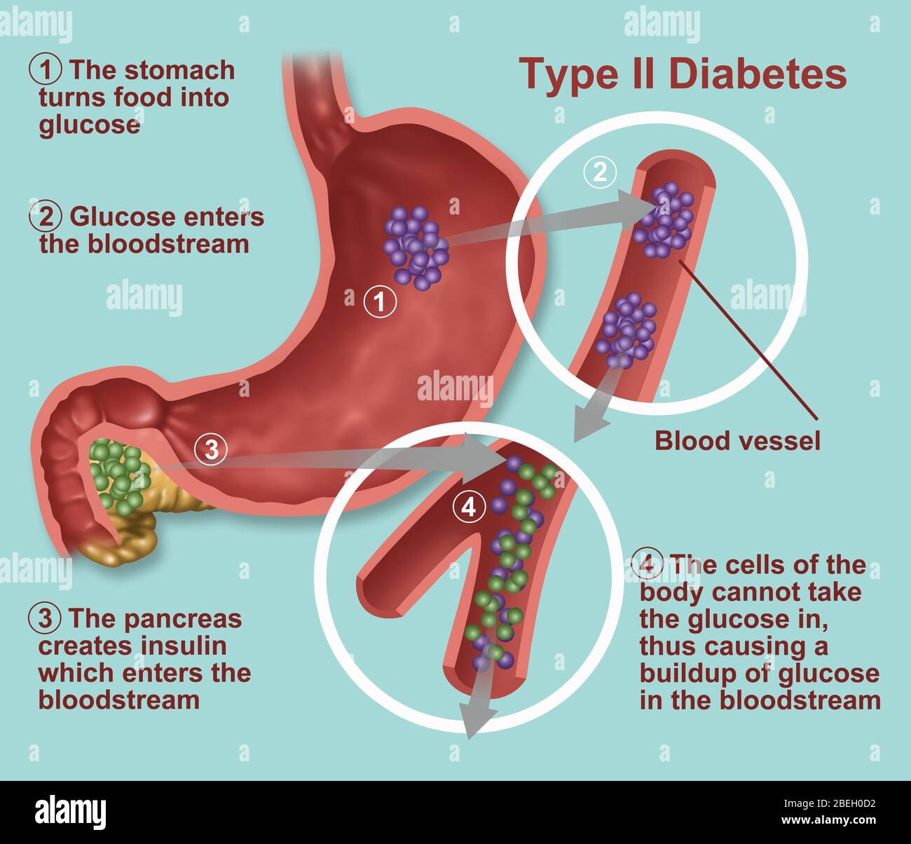 Diabetes Mellitus Type 2 Schematic Diagram Concept Map Diabe Diabetes Mellitus Type 2 Schematic Diagram Concept Map Diabe