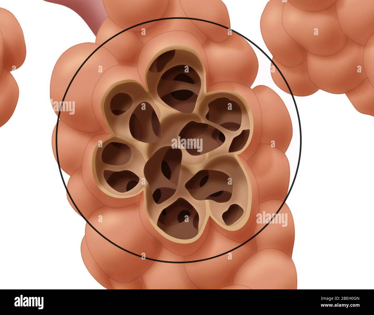 Lung emphysema damage hi-res stock photography and images - Alamy