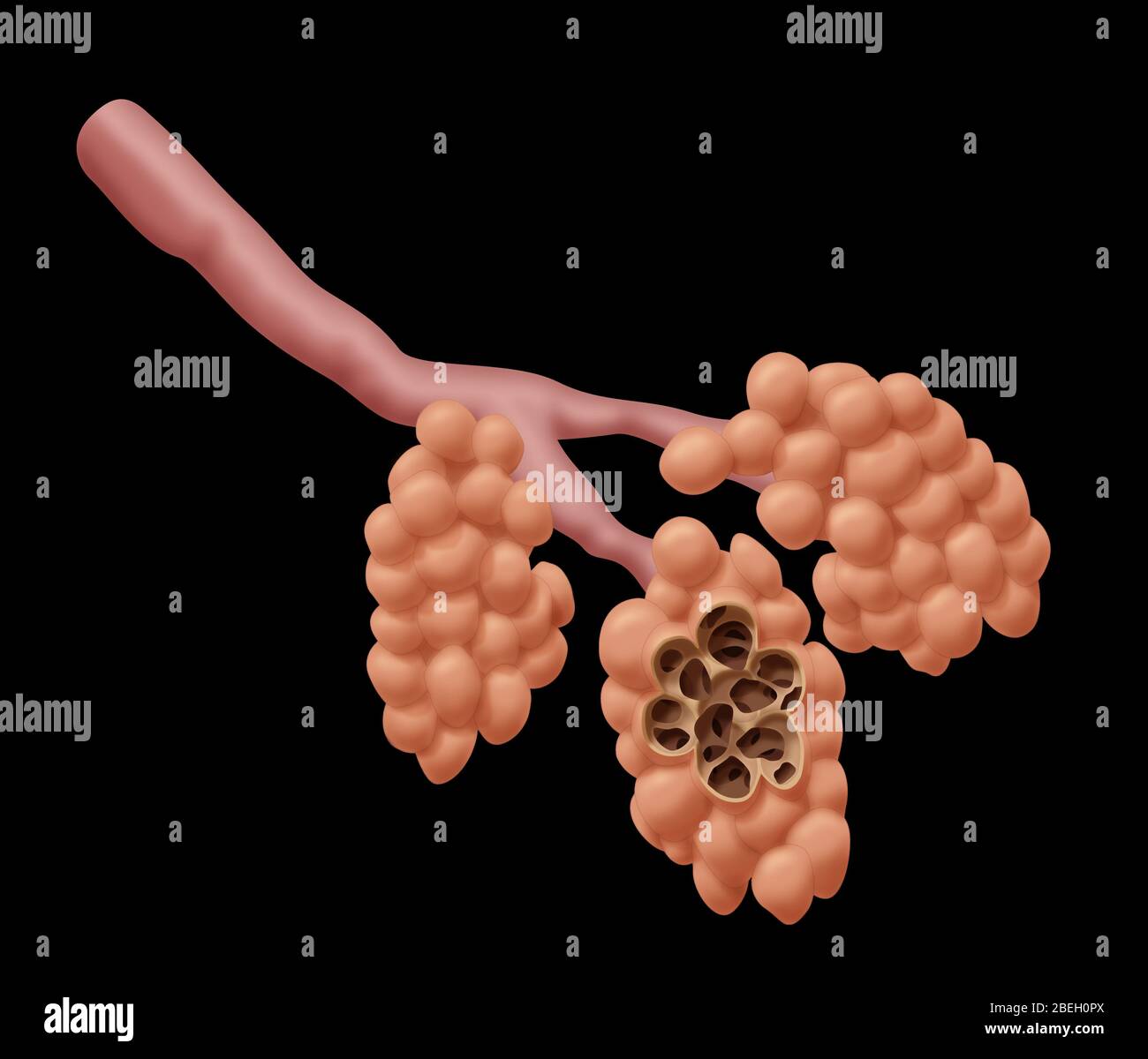 Lung emphysema damage hi-res stock photography and images - Alamy