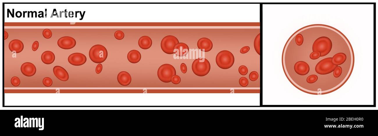Normal blood flow hi-res stock photography and images - Alamy