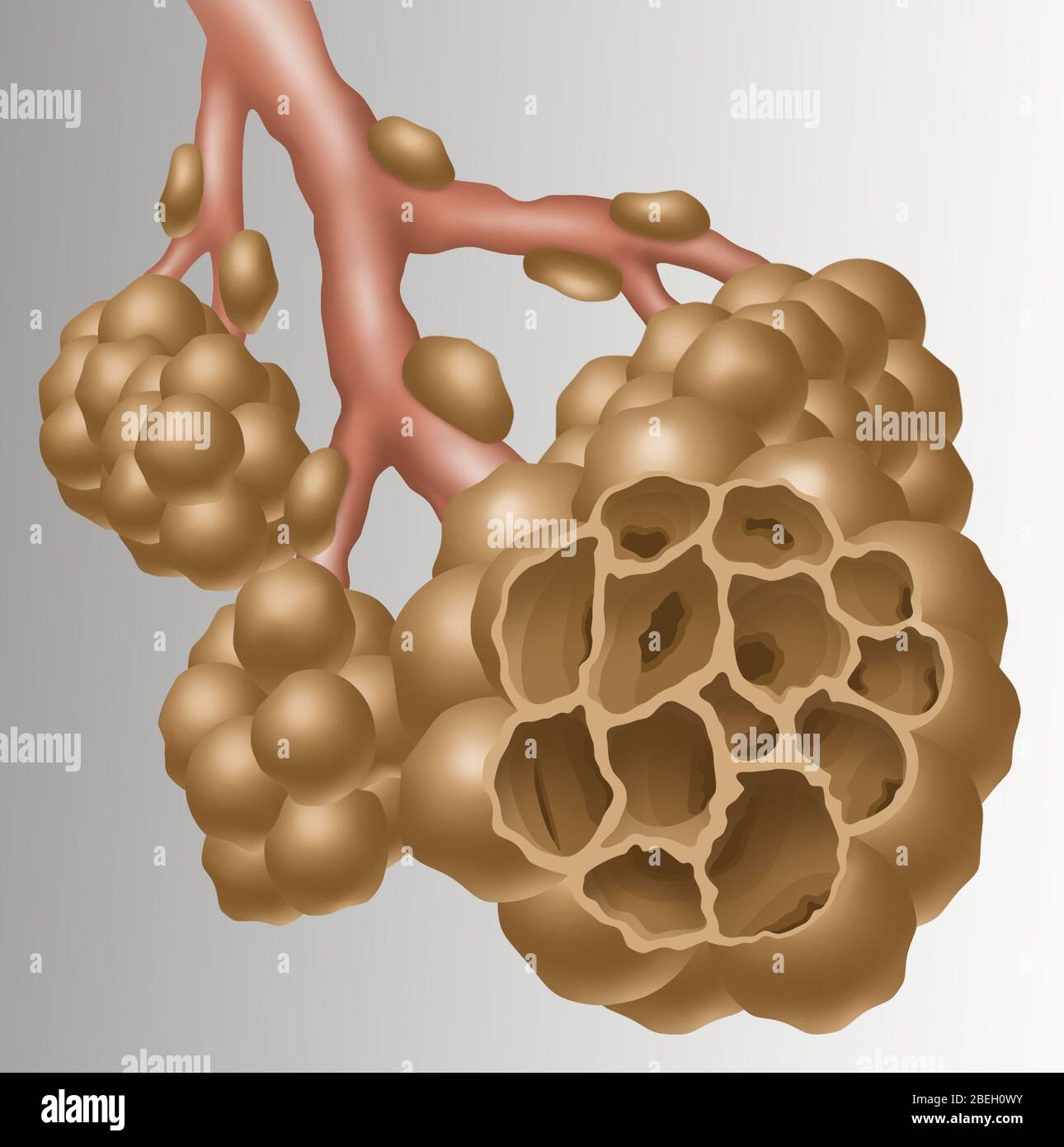 Emphysema copd hi-res stock photography and images - Alamy