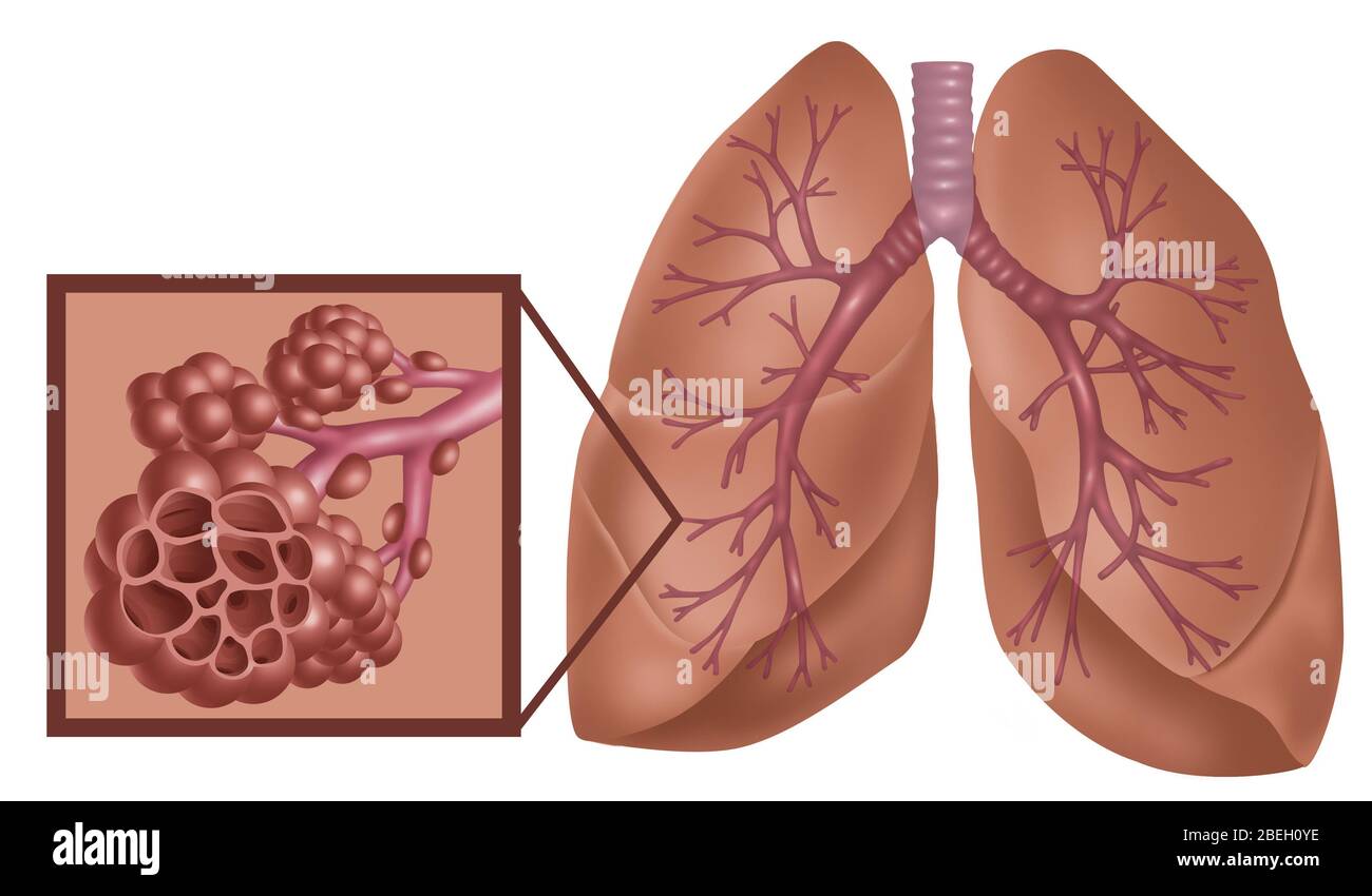 Alveoli Of Lungs High Resolution Stock Photography and Images - Alamy