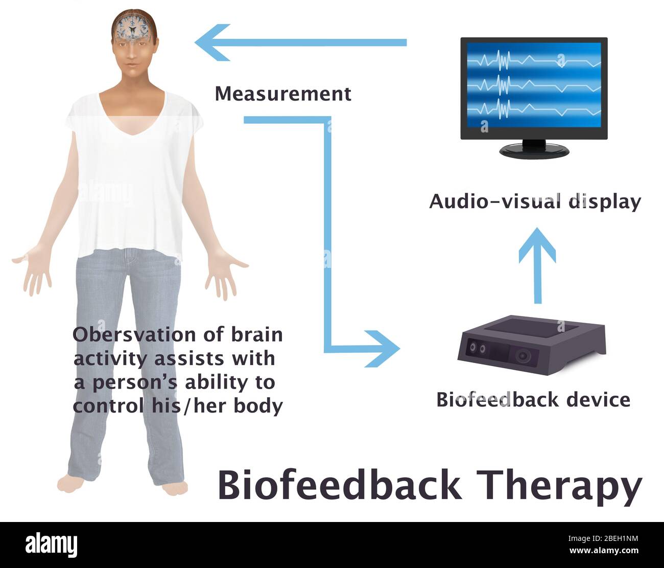 Diagram of Biofeedback Therapy Stock Photo - Alamy