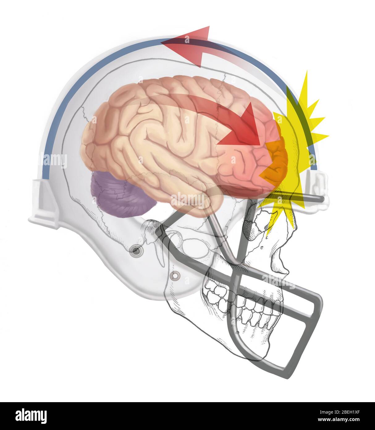 Encephalopathy hi-res stock photography and images - Alamy