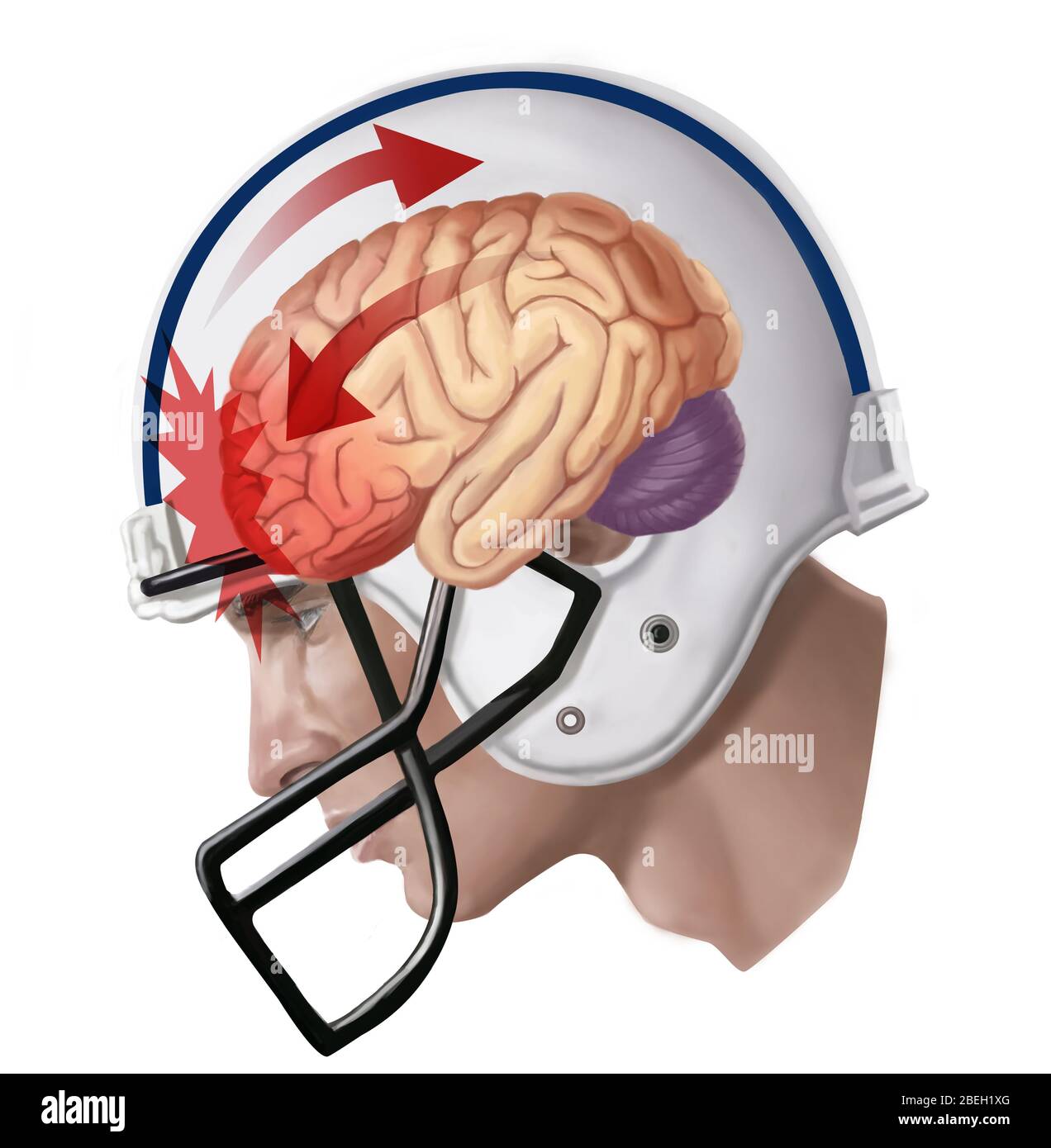 Encephalopathy hi-res stock photography and images - Alamy