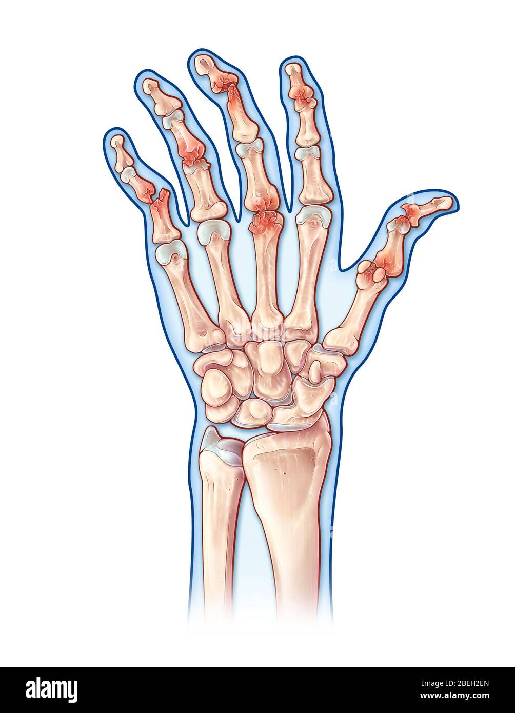 Carpal Bones Labeled