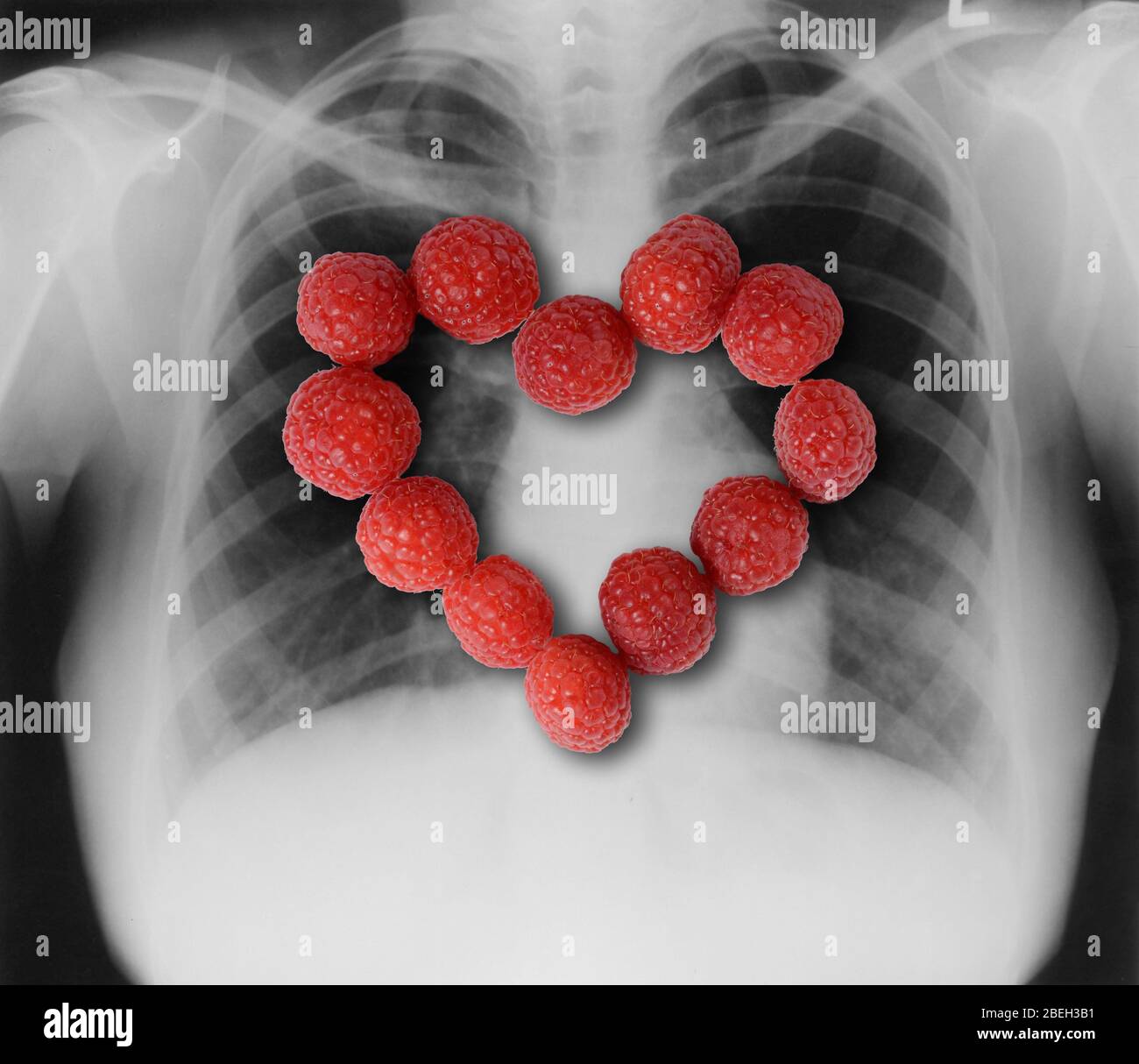 X ray fruit hi-res stock photography and images - Alamy