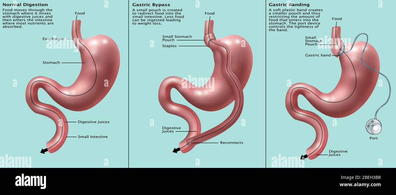 Digestive system diagram hi-res stock photography and images - Alamy