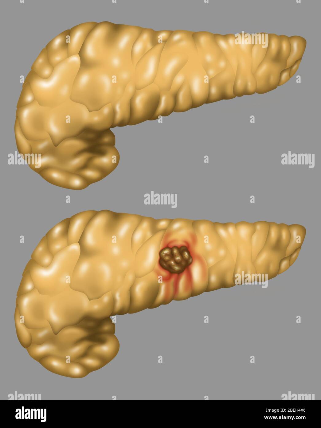 Healthy pancreas hi-res stock photography and images - Alamy